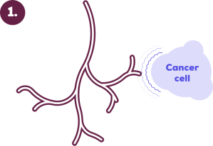 About My Treatment (GB) - Keytruda UK